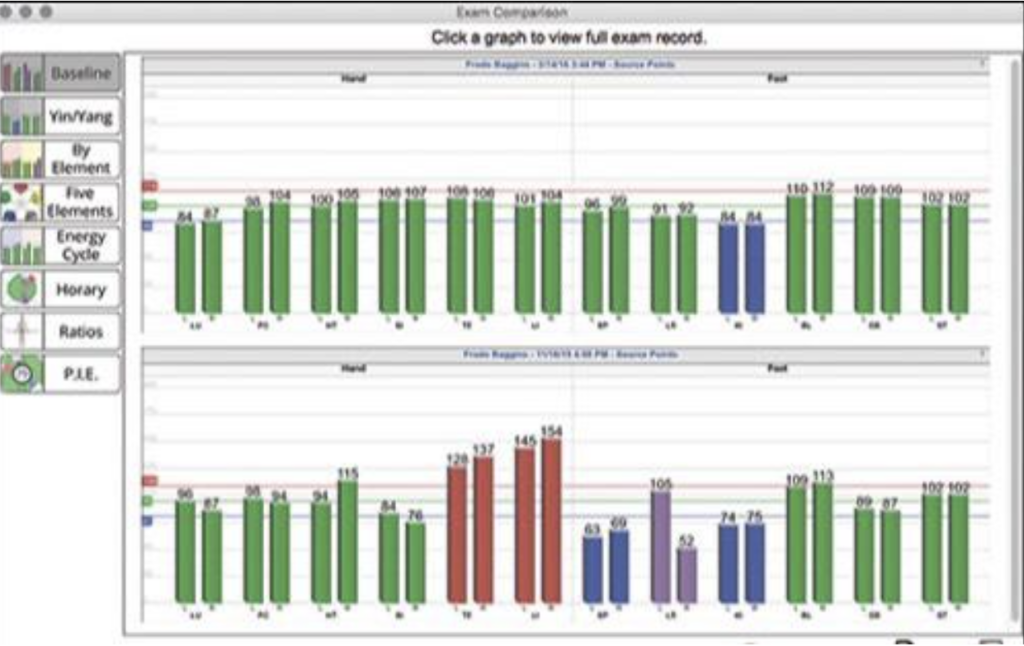 Acugraph in Marietta GA - Acupuncture & Injury