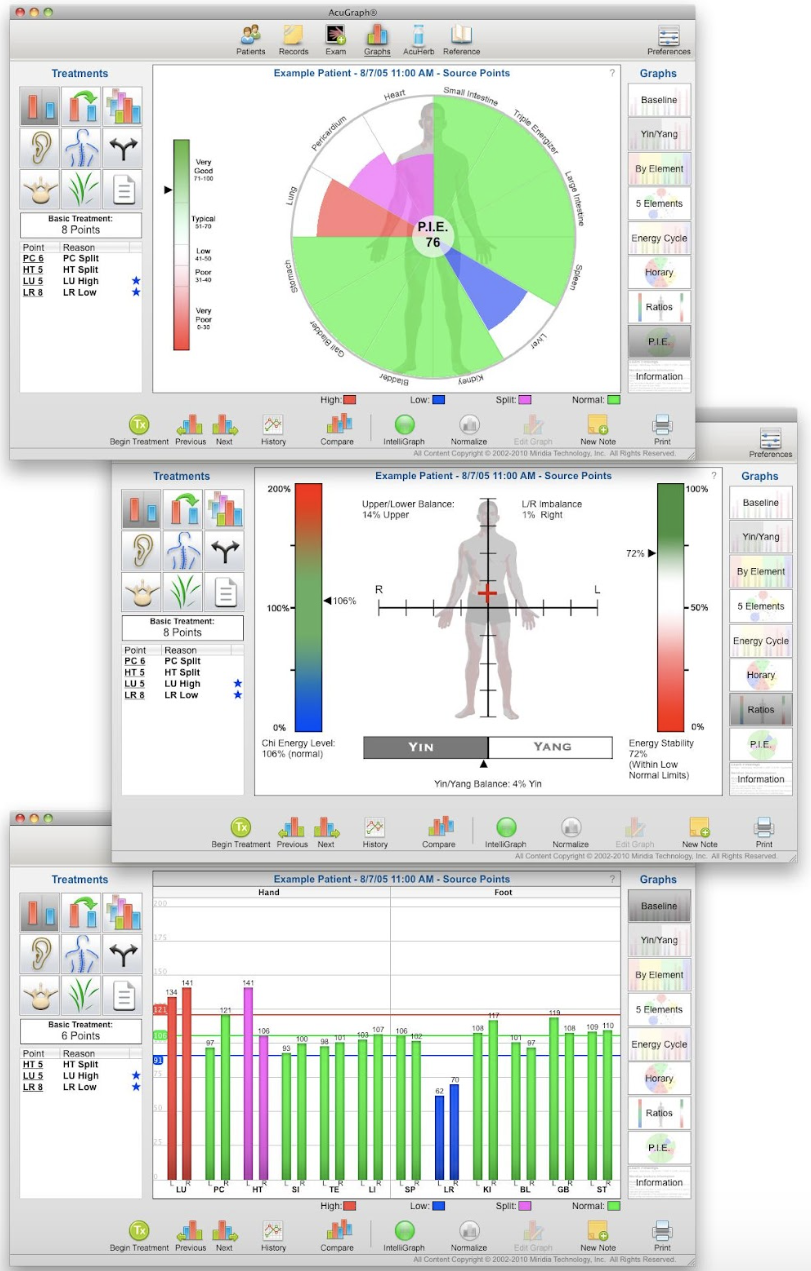 Acugraph in Marietta GA - Acupuncture & Injury